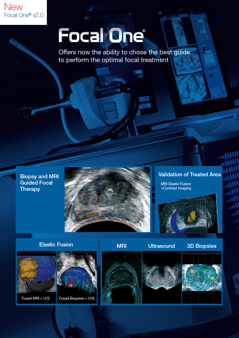 Focal One v 2 — Hifu Kliniek Nederland