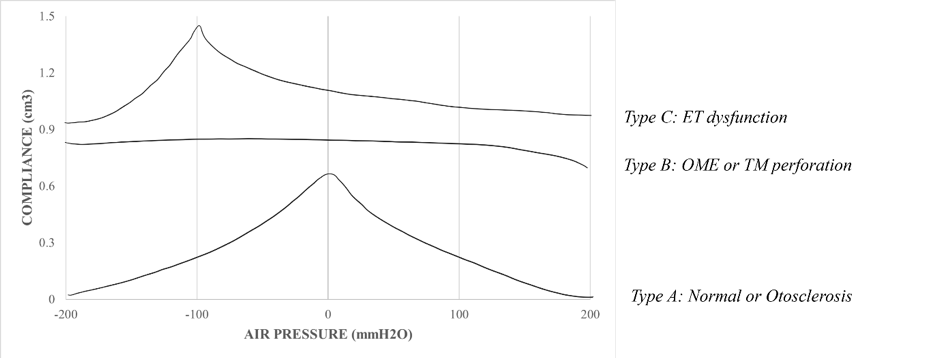 Audiometry — entsho.com