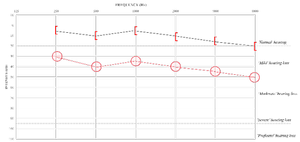 Audiometry — entsho.com