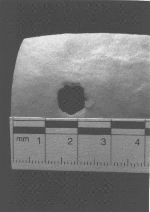 Forensics 101: Bullet Wounds in Bone—The Skull — Jen J. Danna/Sara ...