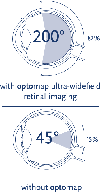 Optomap Retinal Imaging | Eye Care Nashville | Look East | Look East