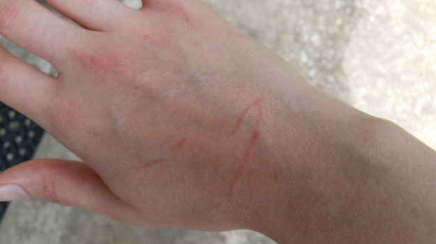 Is It Normal For A Puppy To Scratch