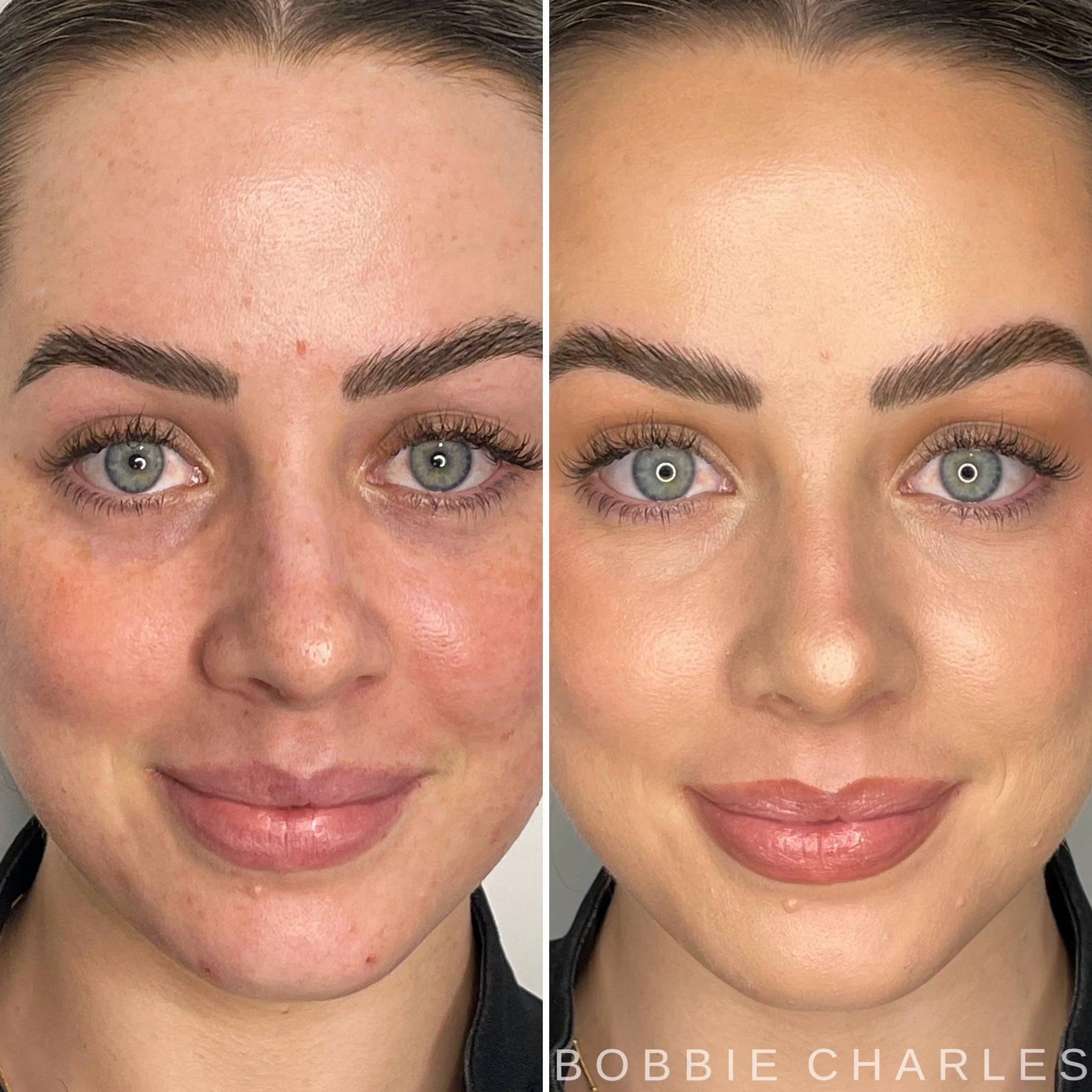 Best Mineral Makeup After Laser | Saubhaya Makeup