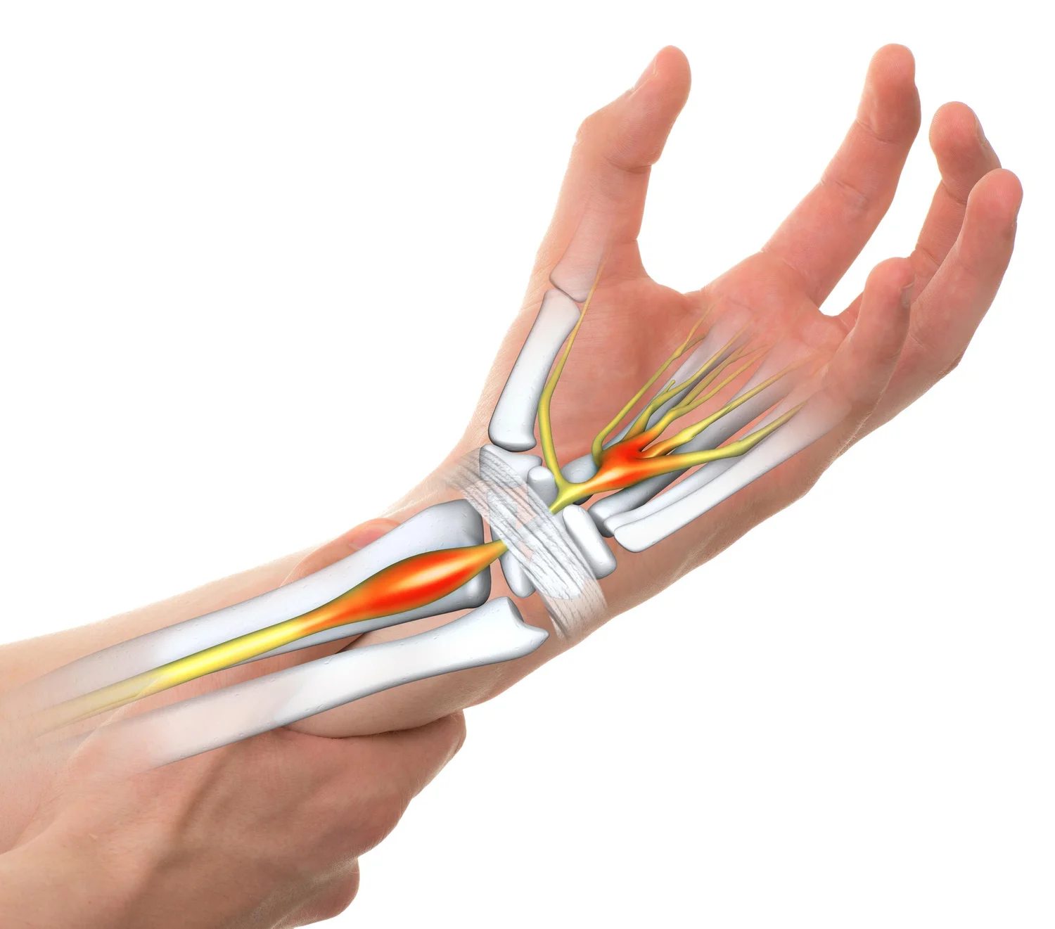 Hypermobility Spectrum Disorder: The Flexibility Factor, INTEGRATIVE PHYSIO