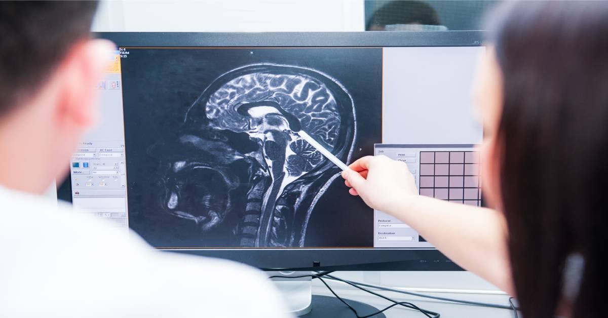 Concussions Explained: Key Symptoms & Recovery Tips