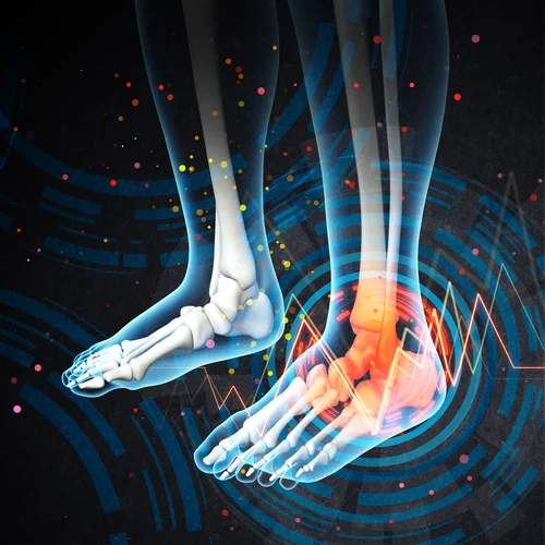 Susan Schneidermesser DPM | Philip Schatz DPM | Prospect Park Podiatry