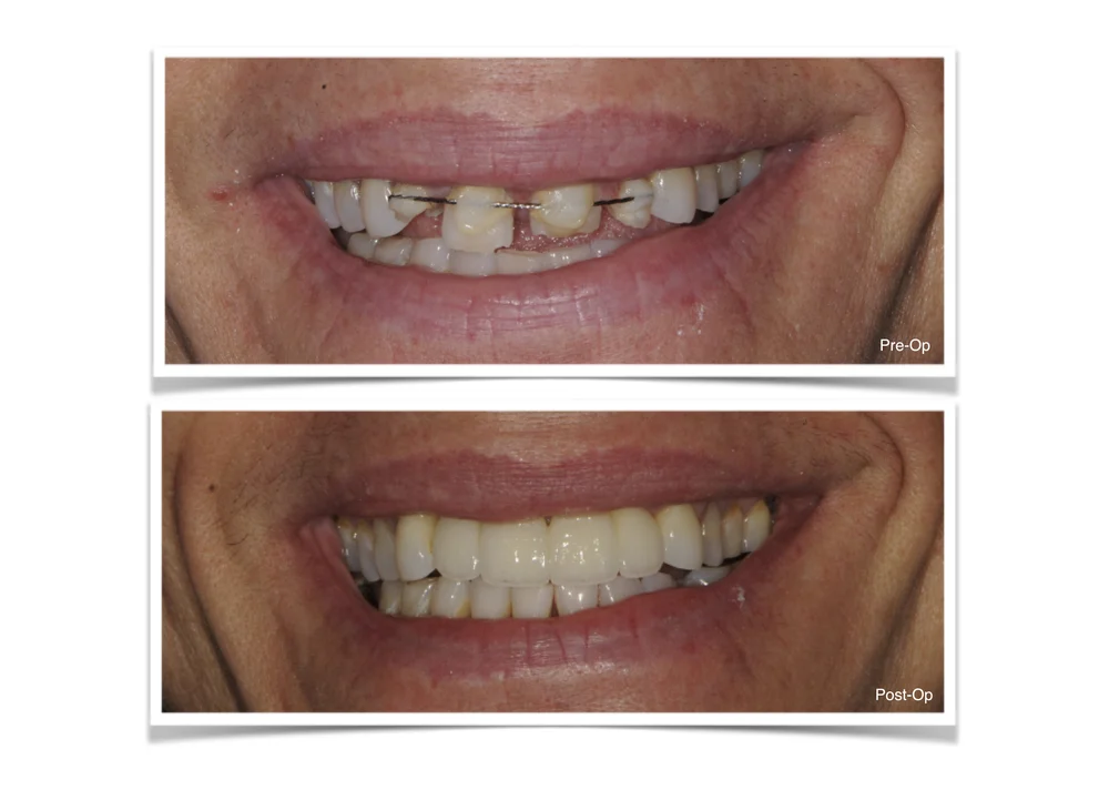 Smile Makeovers & Cosmetic Dentistry Results | CJ Henley DMD ...