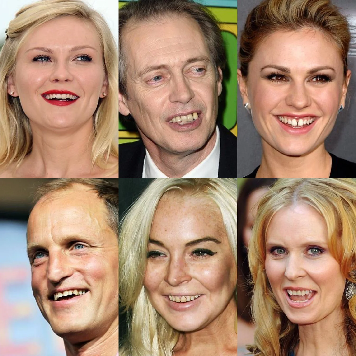 Kirsten Dunst Bad Teeth