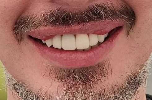 ABC Dental Portfolio - Before / After of our cases | ABC Dental