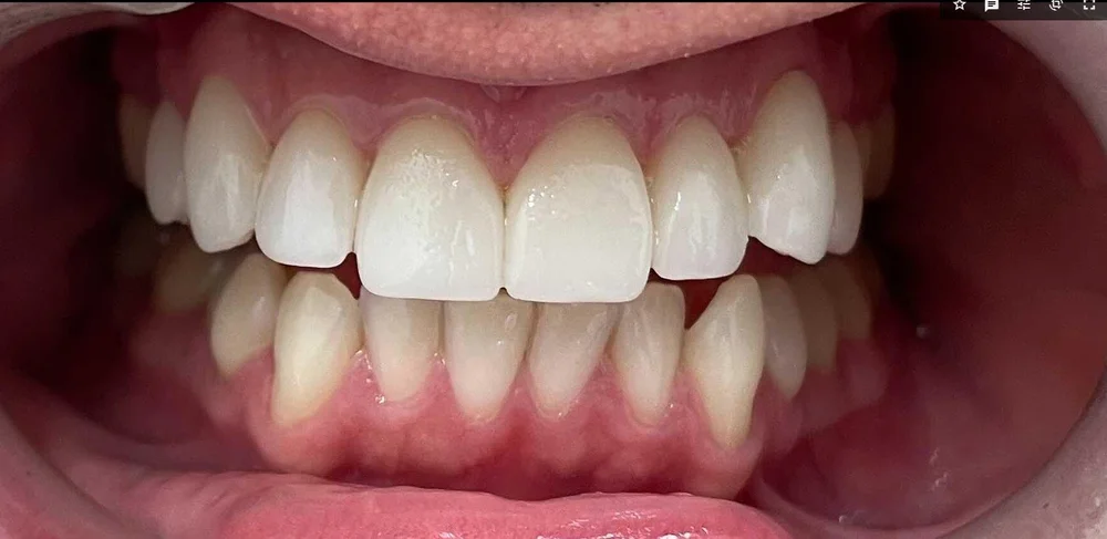 ABC Dental Portfolio - Before / After of our cases | ABC Dental