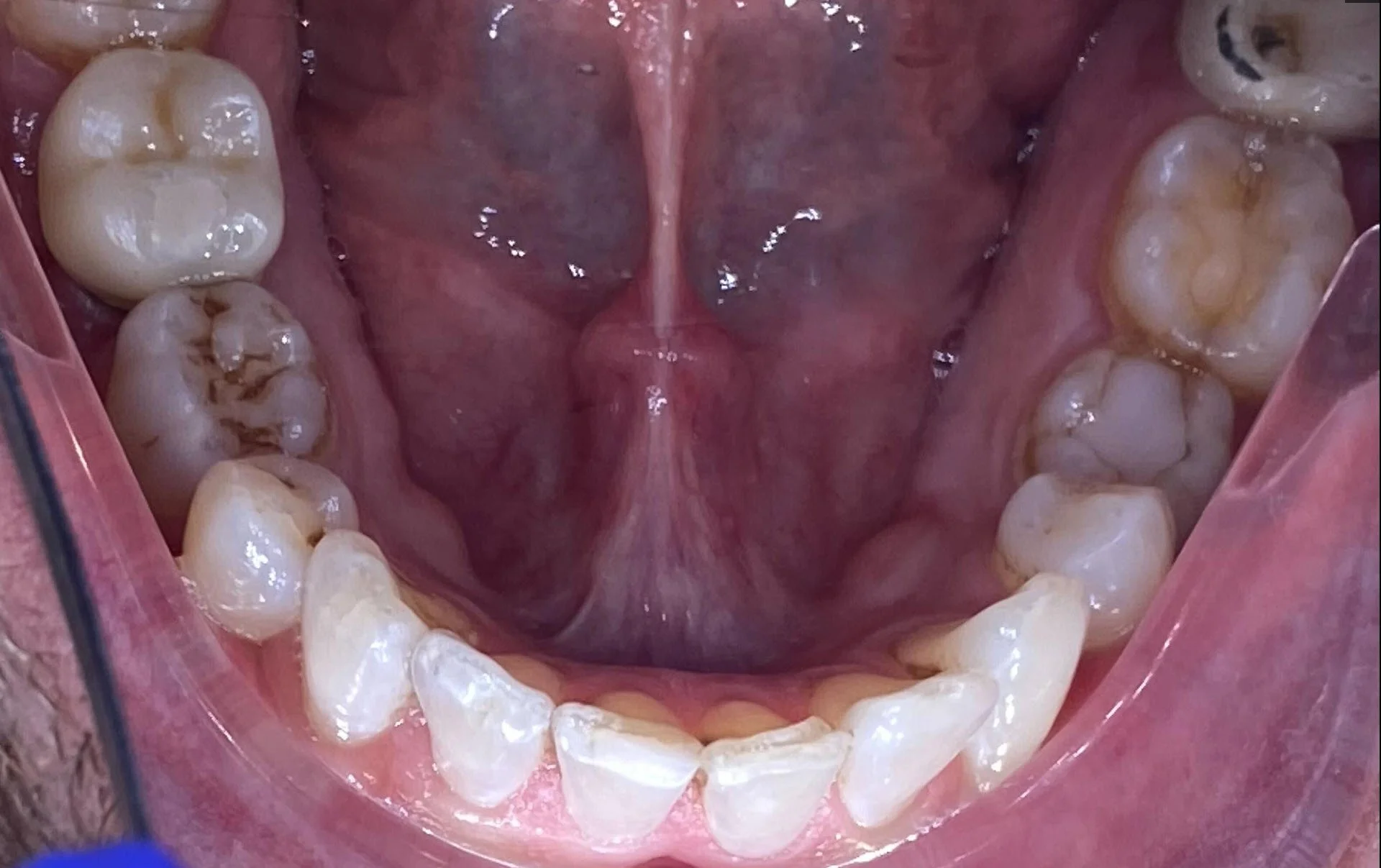 Justin 64 ABC Dental