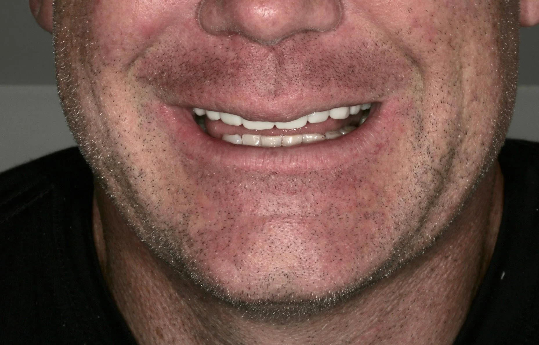 ABC Dental Portfolio - Before / After of our cases | ABC Dental