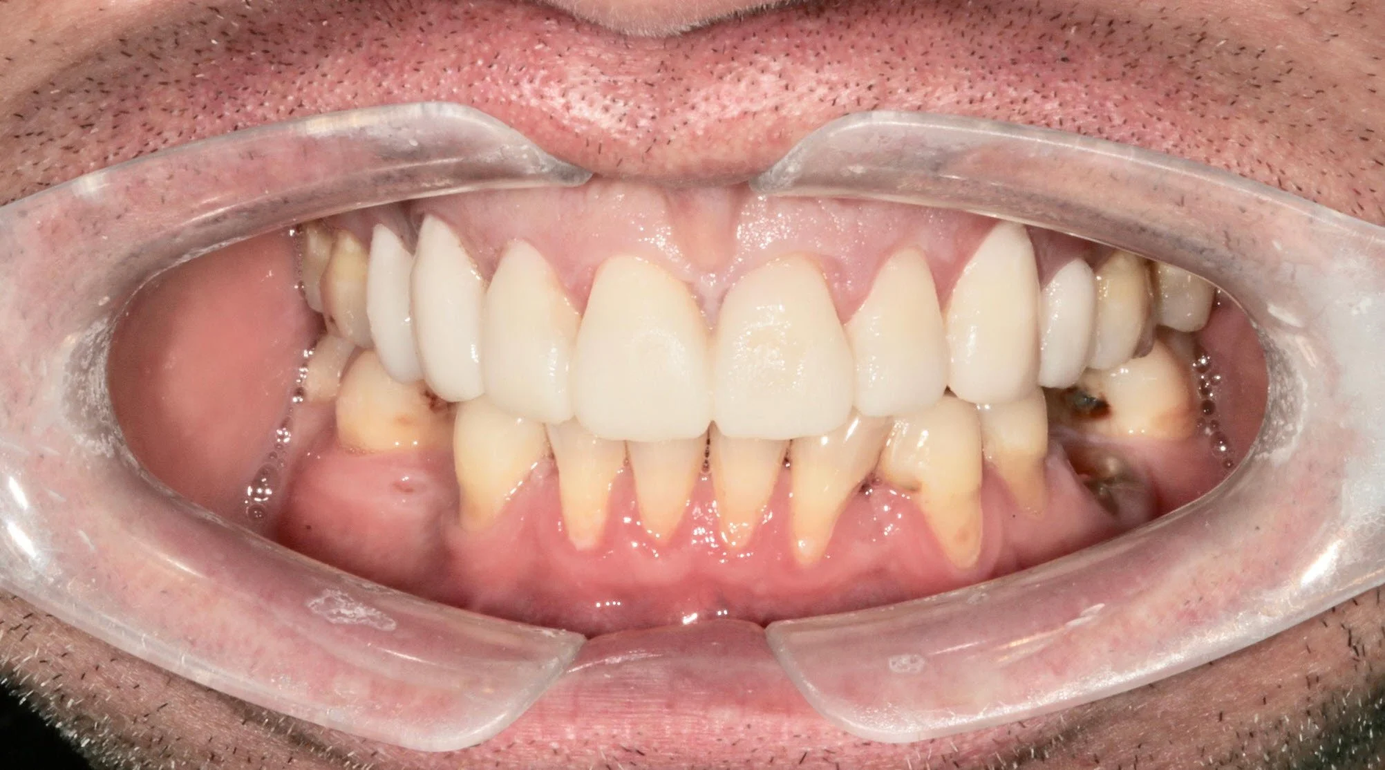 Ben ABC Dental