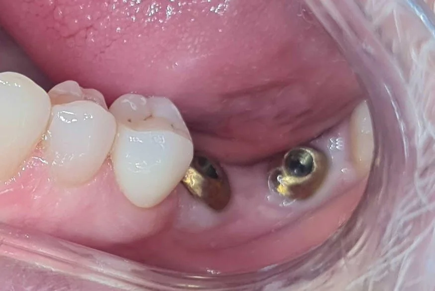 Stephen 57 ABC Dental stephen-57-abc-dental