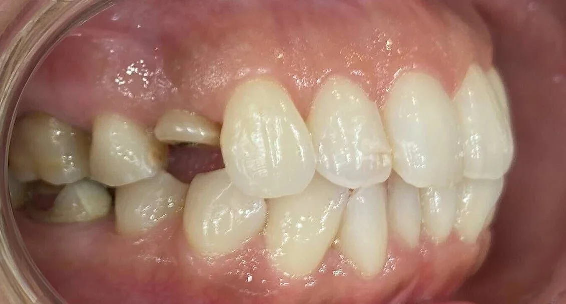 Junko 66 | ABC Dental