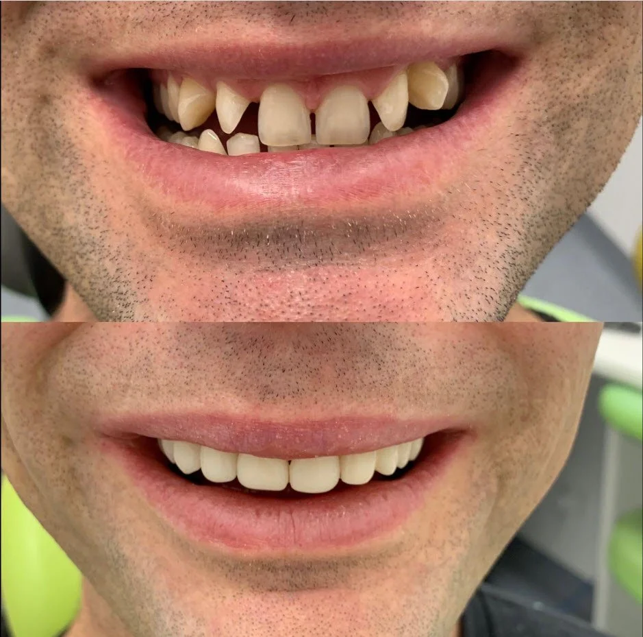 Cameron 37 | ABC Dental