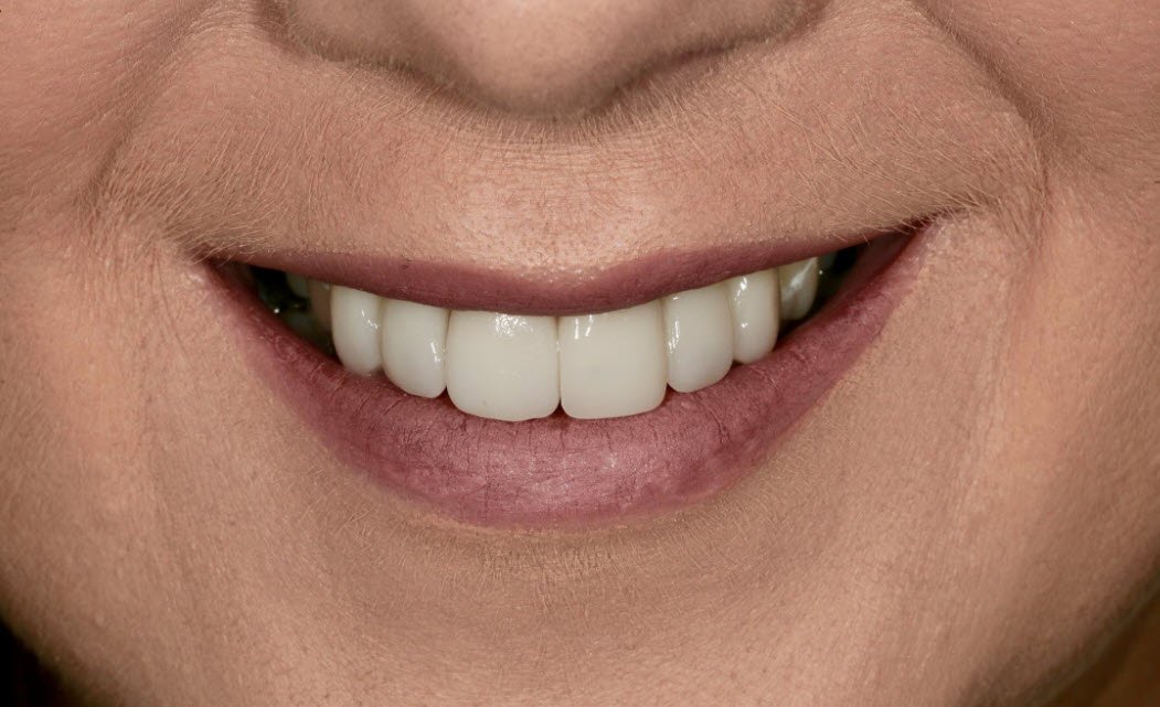 ABC Dental Portfolio - Before / After of our cases | ABC Dental