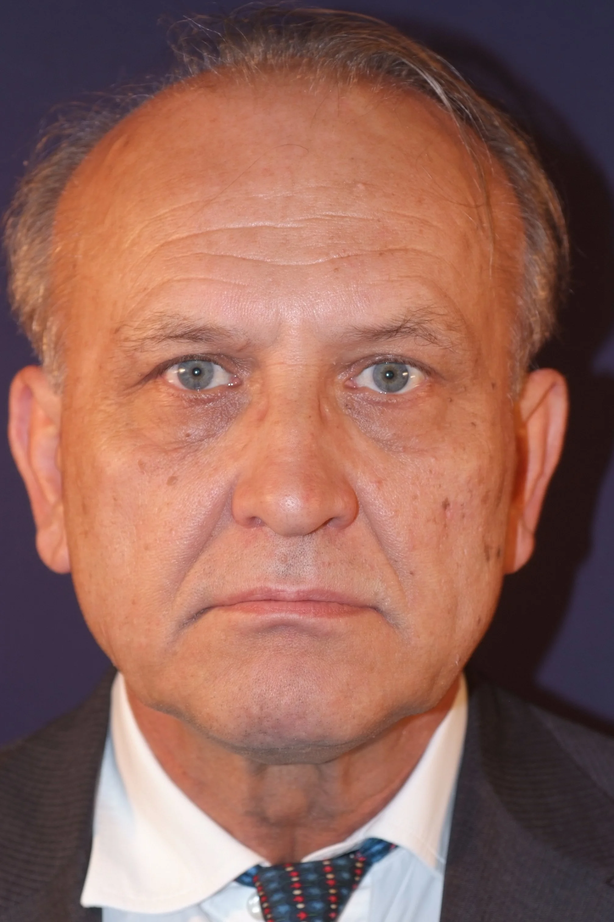 #1 Top Cosmetic Surgeon London in 2025 – Jan Stanek