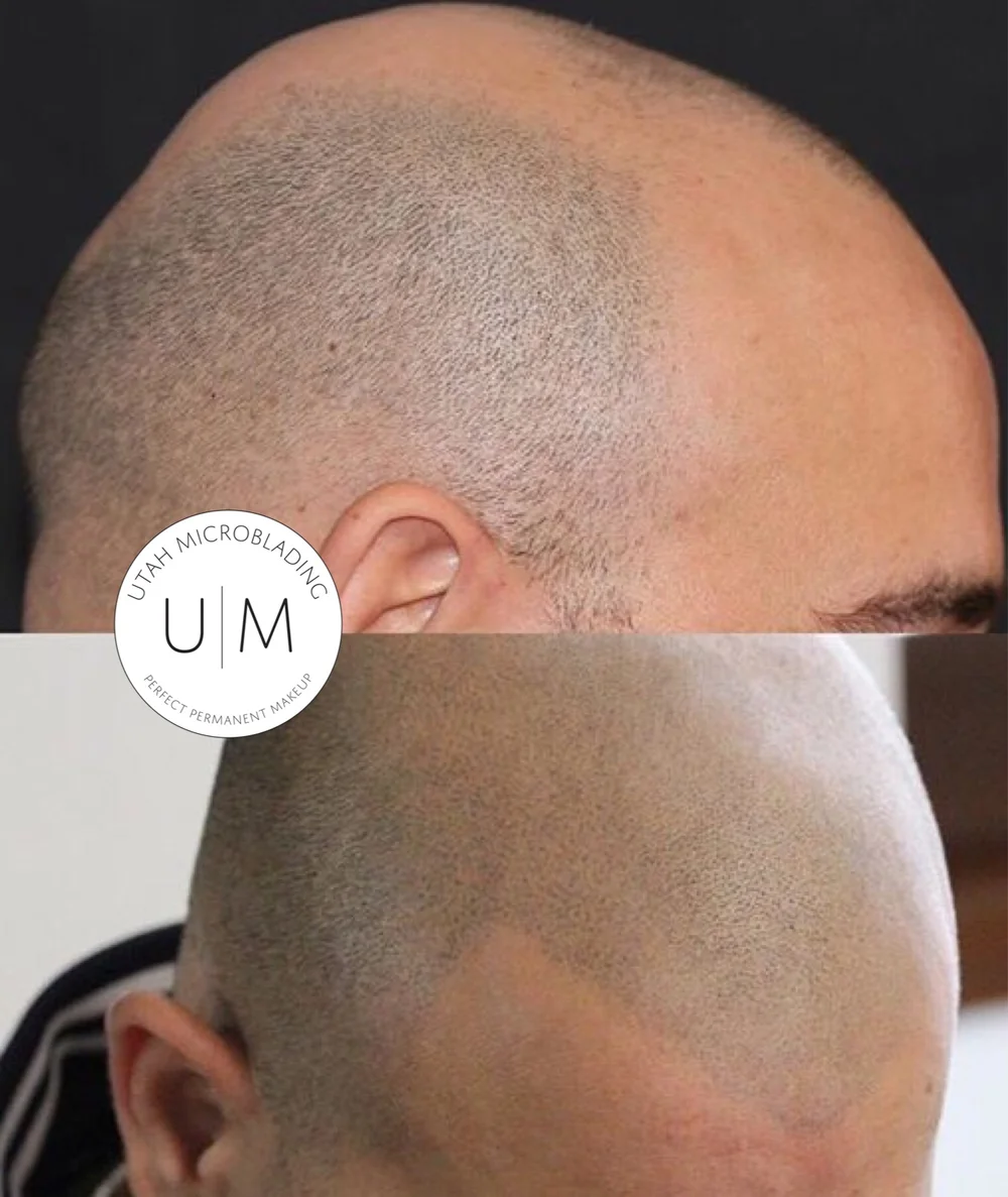 Scalp Micropigmentation in Salt Lake City, Utah — Utah Microblading