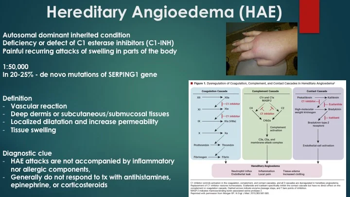 Hereditary Angioedema — learnED