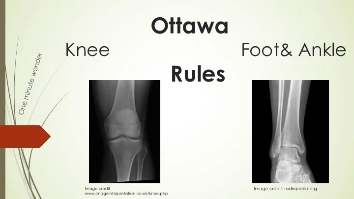 Ottawa Wrist Fracture Rules | Tiny Tip: The Ottawa Ankle and Foot Rules ...