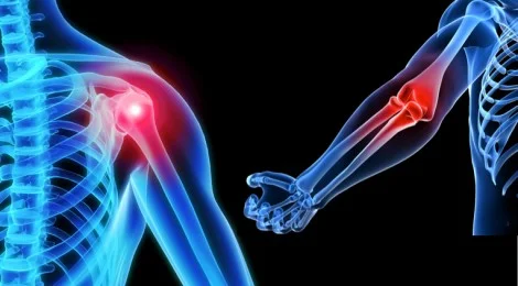 Of Shoulders, Elbows, and More To Come... | Articles – Power Company ...