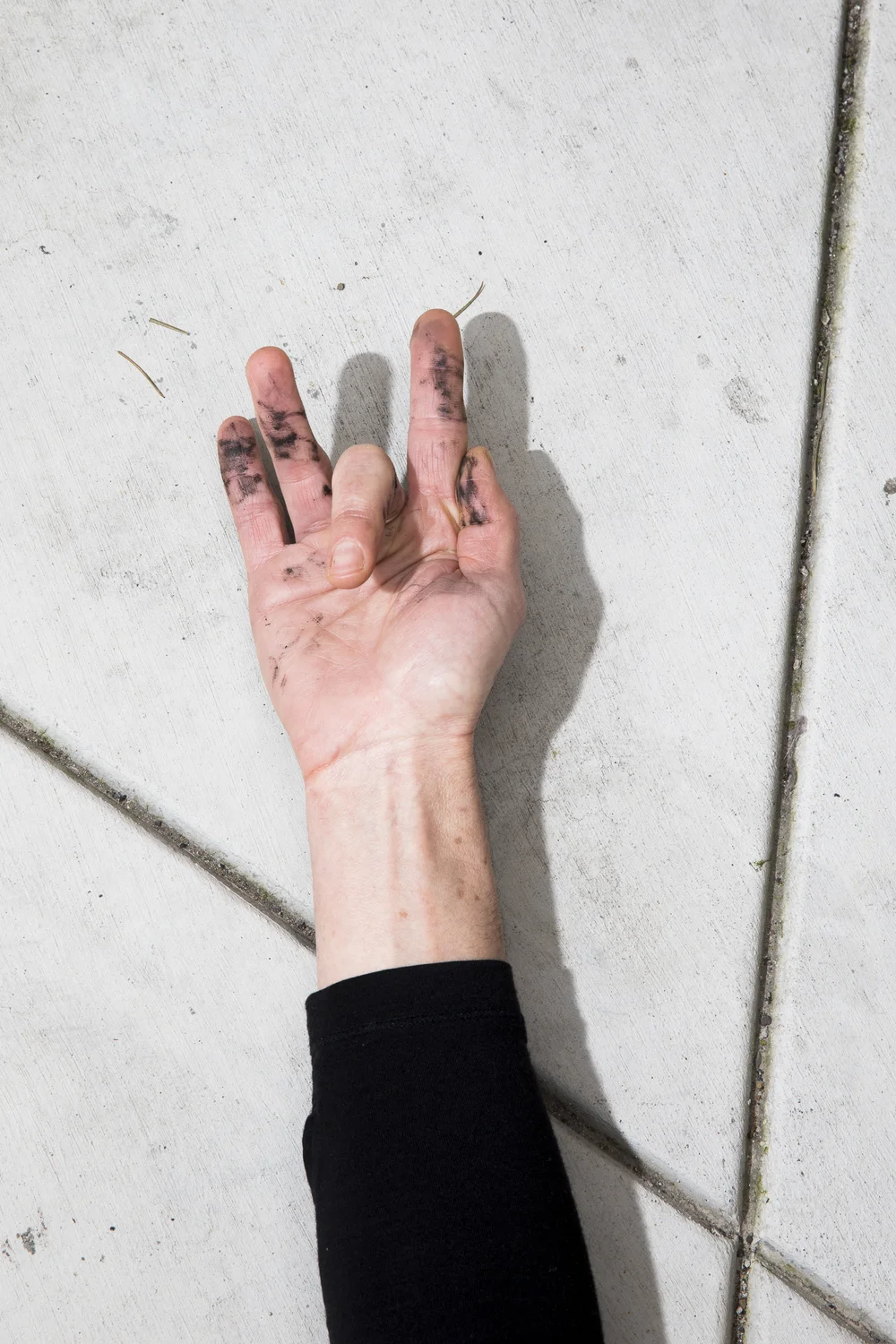 Bruised Hands Tumblr