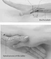 Healing at Home: Acupressure to boost immunity — Synergy Acupuncture ...
