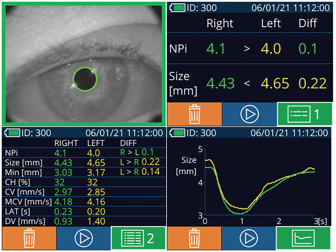 Retrieval Practice and Processing Load — The Learning Scientists