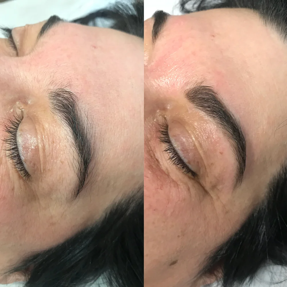 Eyebrow Waxing Before And After Guys