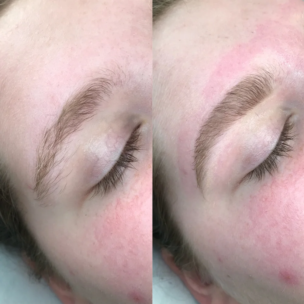 Waxing Eyebrows Before And After