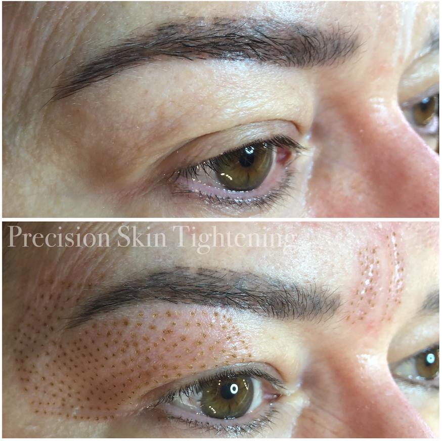 Precision Spa - Professional Beauty Treatments