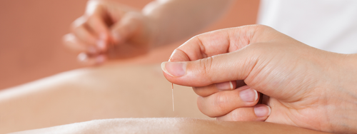 5 Things you should know about Fertility Acupuncture — Blooming Poppy ...