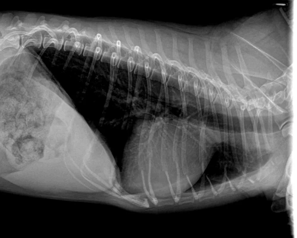 What Is an Over-Exposed X-Ray, and Why Does It Matter?