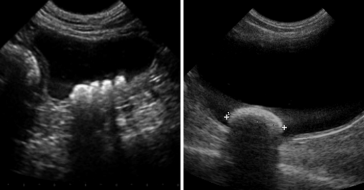 Diagnosing Bladder Stones in Pets: What You Need to Know