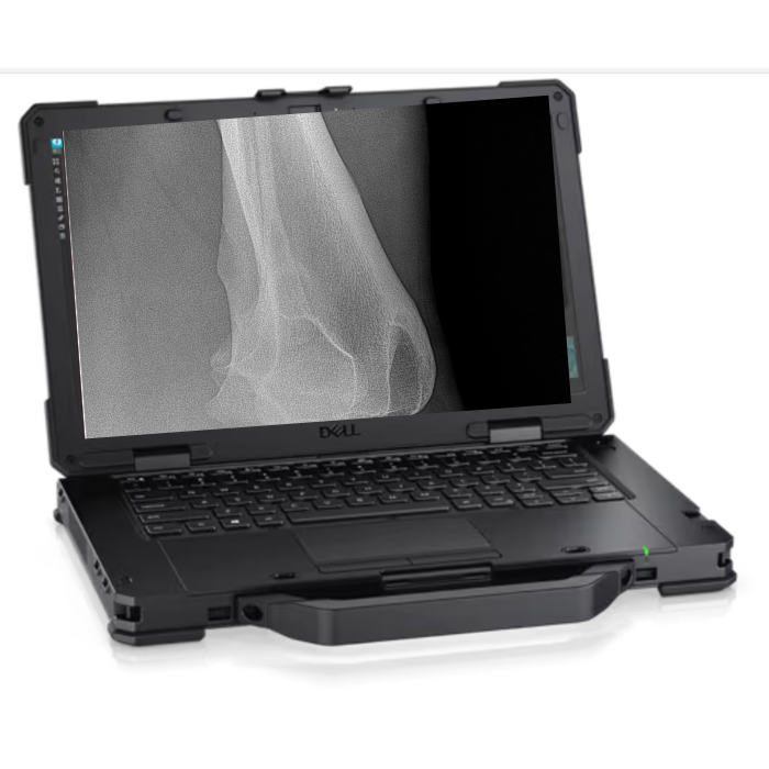 DR Digital X-Ray System for Mobile Veterinary or Equine Services