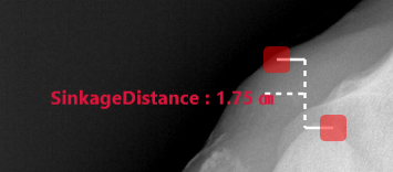 Taking, Measuring, & Interpreting Rads of the Equine Foot