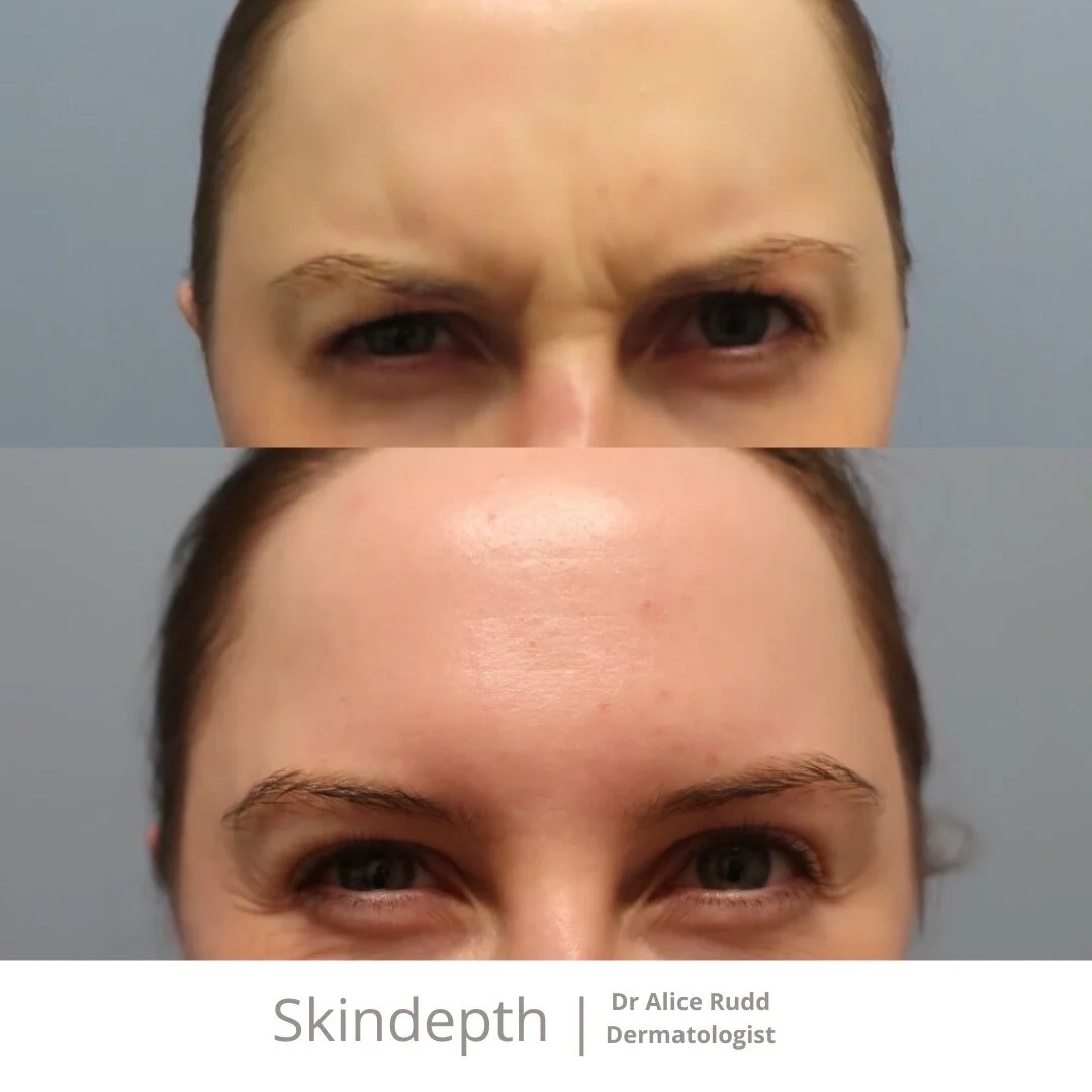 Skin Depth Dermatology