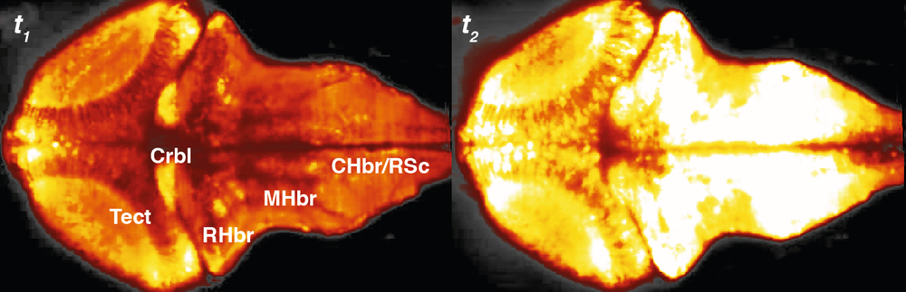 Modelling Epilepsy in Zebrafish — Dynamic Brains