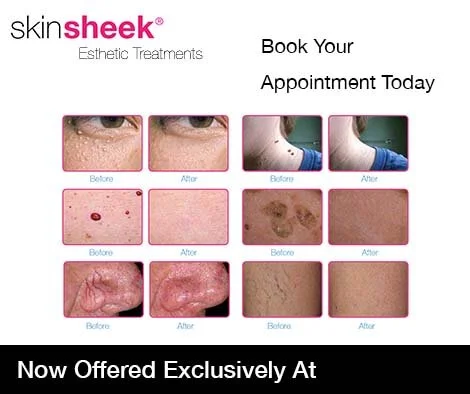 Skin Facial Treatments & Facial Massage | Skin Spa Asheville