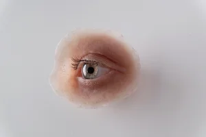 Anaplastology — Medical Arts Clinic - The Anaplastologist