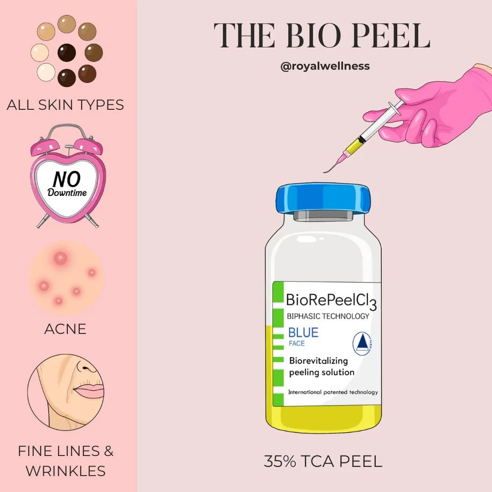 BioRePeel — Royal Aesthetics