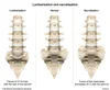 Lumbarization and sacralization — Cote Illustration