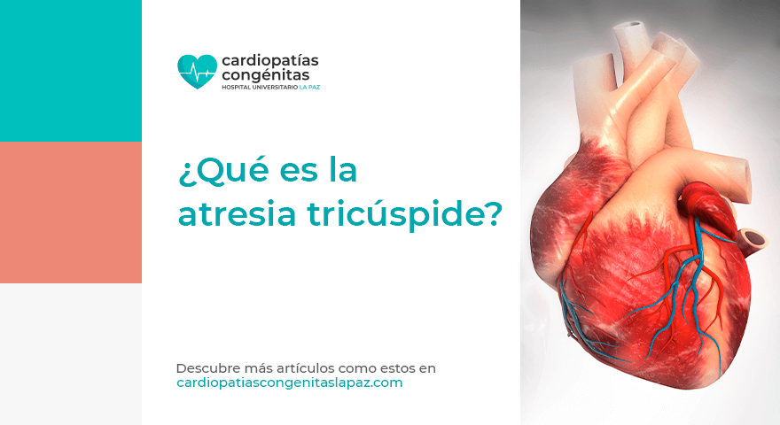 Qué es la atresia tricúspide — Cardiopatías Congénitas La Paz
