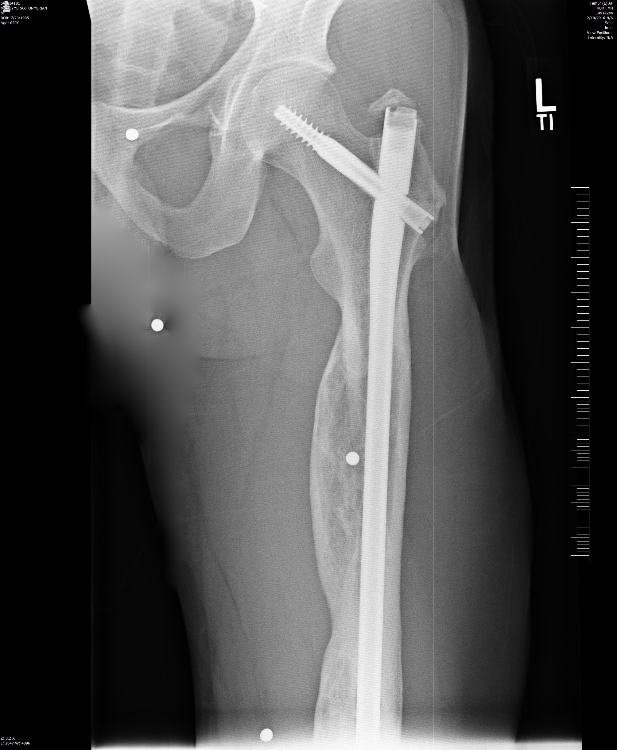 My Story — Braxton McCoy