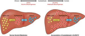 10+ Reasons Why Alcohol Intolerance Happens And How To Build Alcohol ...