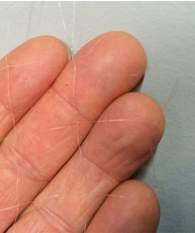 Best Hair Extensions NJ | Non Surgical Hair Replacement NJ ...