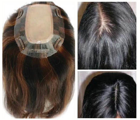 Non-Surgical Hair Replacement NJ | InvisaBlend Studio