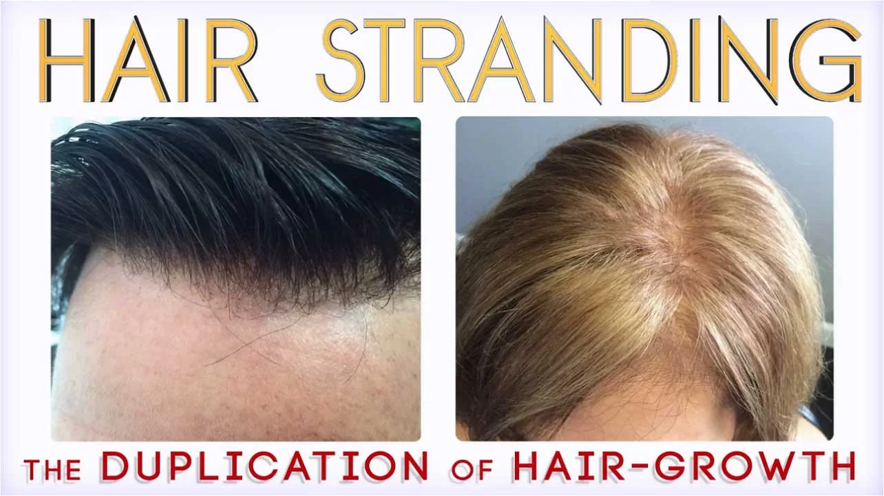 Hair Replacement Englewood NJ | Revolutionary Hair Addition NJ, USA