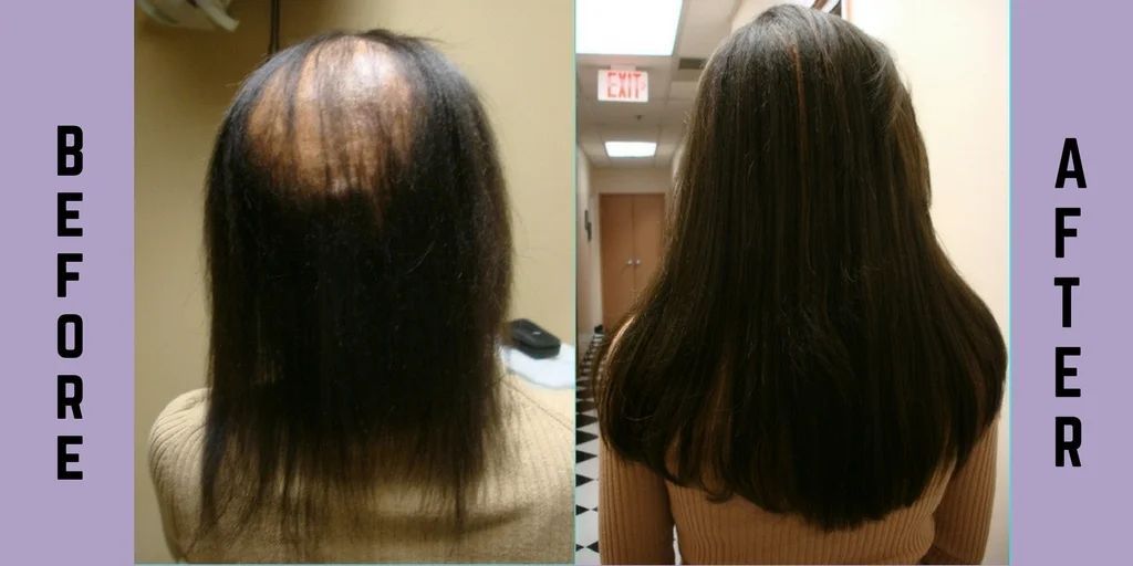 Hair Stranding by InvisaBlend NJ, USA | HEALTHY Method to Adding Hair